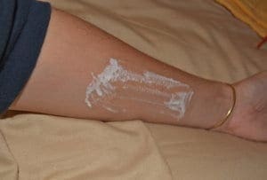 Halloween FX Wound and Burn Makeup Tutorial - Family Focus Blog