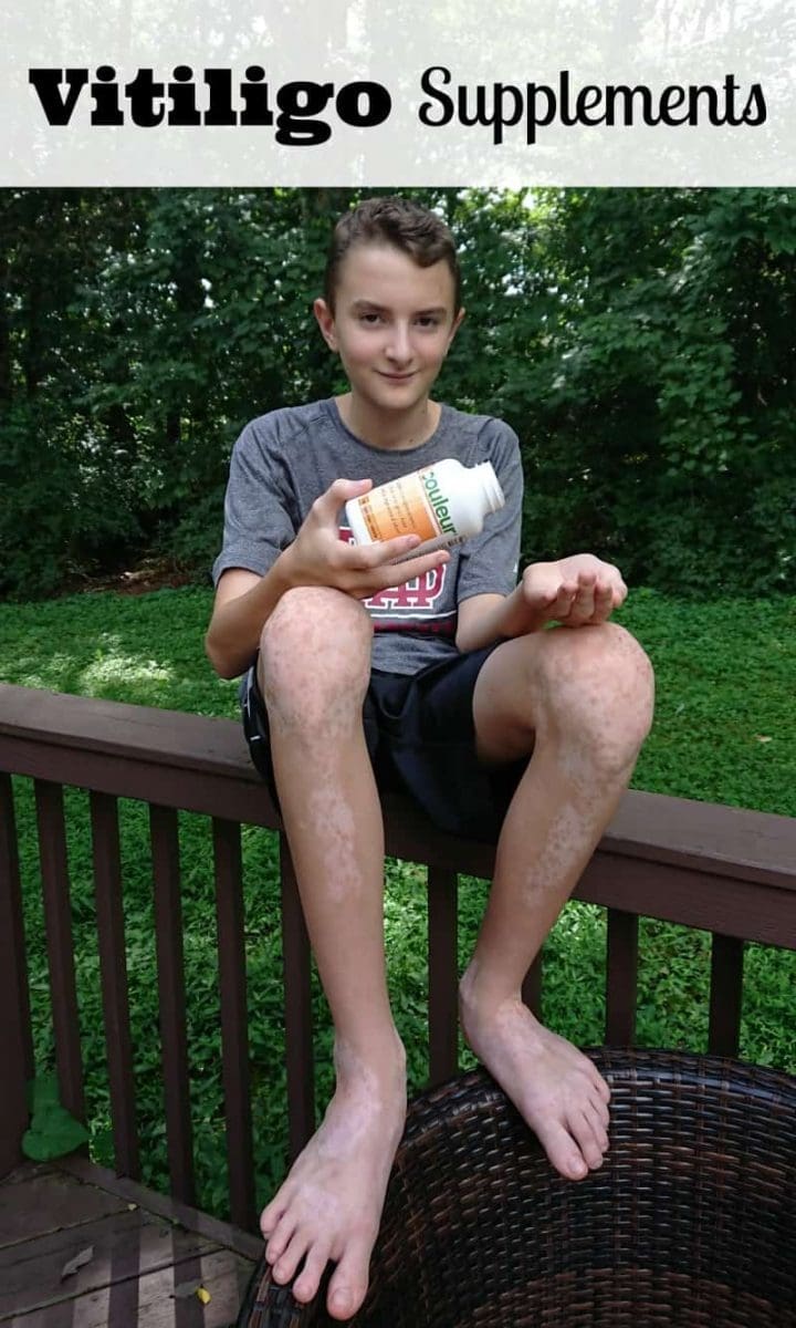 Vitiligo Supplements- Gingko Biloba and Recouleur Vitamins